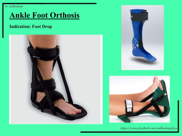 Orthopedic Splints and Casts- Subhadeep PGModules.pptx | Death, Injury ...