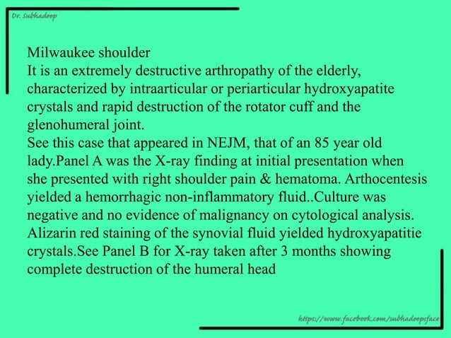 Orthopedic Splints and Casts- Subhadeep PGModules.pptx