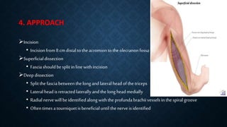 (Orthopedics) post. approach to the humerus by dr. kalimullah wardak ...