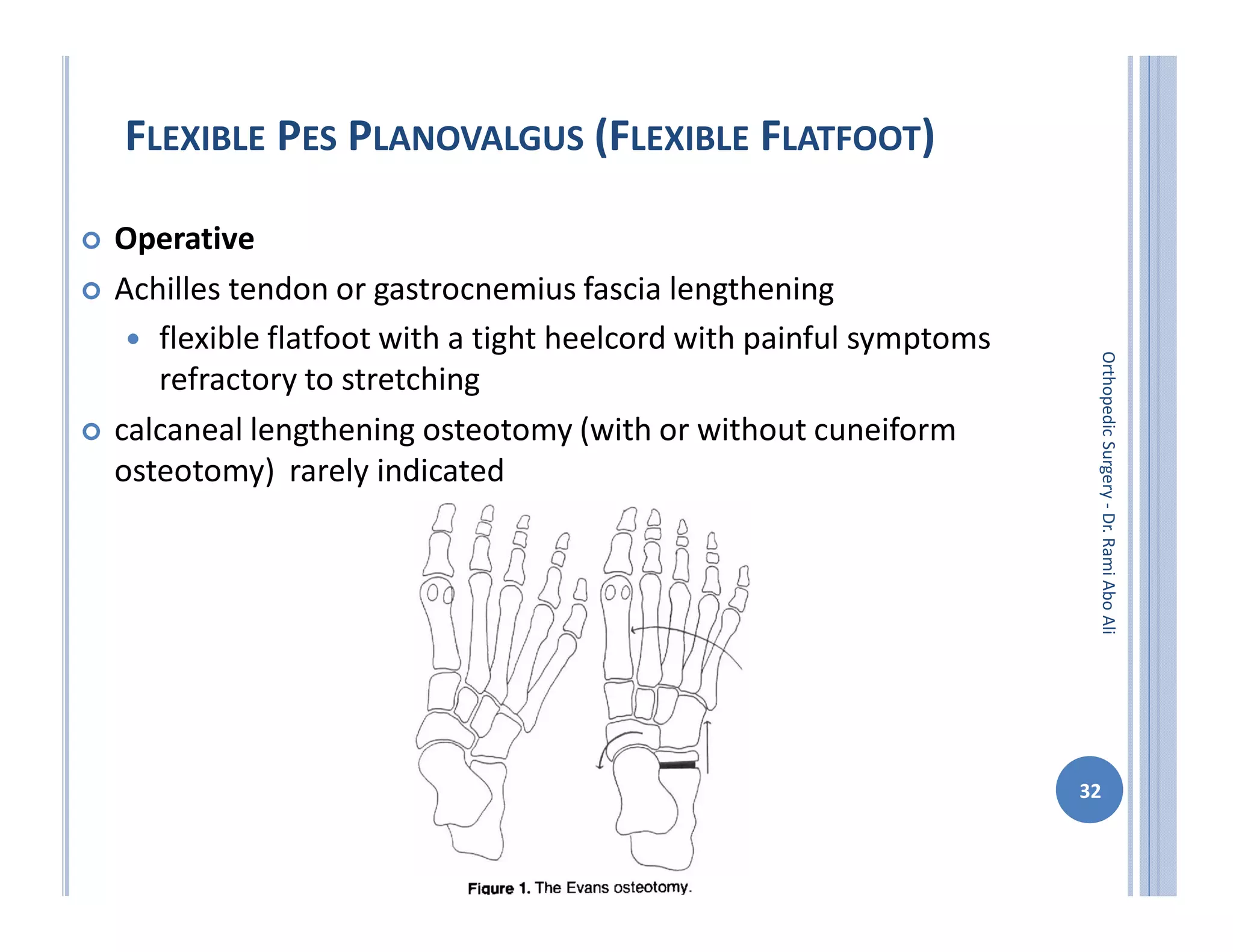 Orthopedic surgery 10th pediatric orthopedic ( 2 ) | PDF