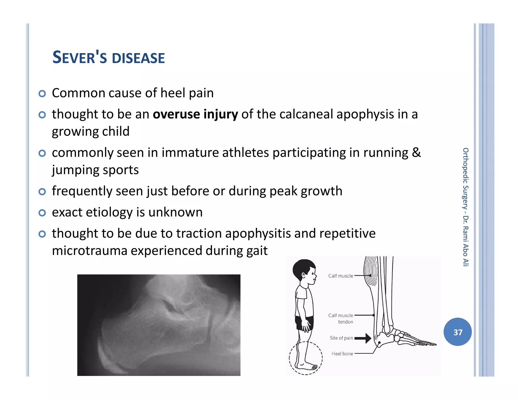 Orthopedic surgery 10th pediatric orthopedic ( 2 ) | PDF