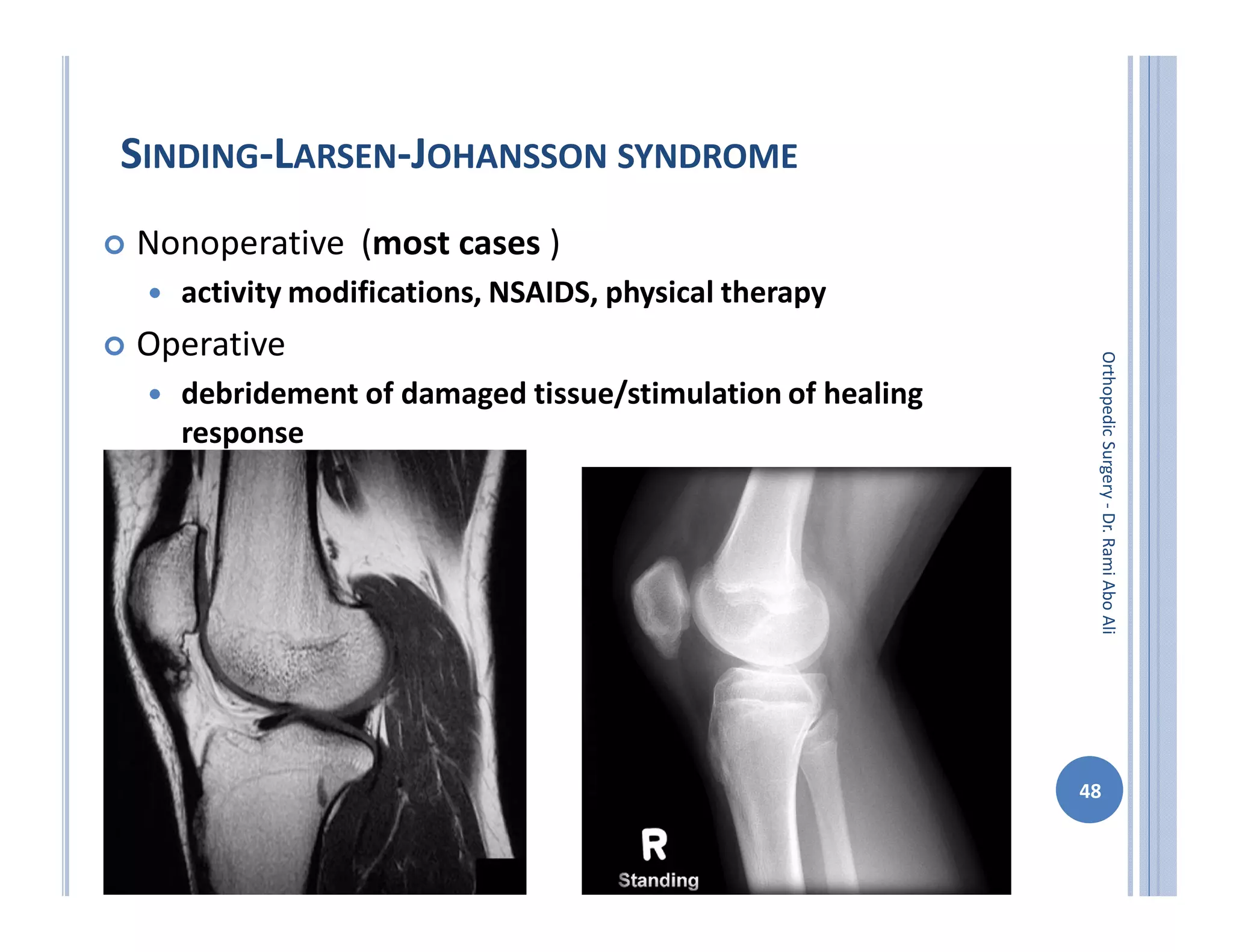 Orthopedic surgery 10th pediatric orthopedic ( 2 ) | PDF