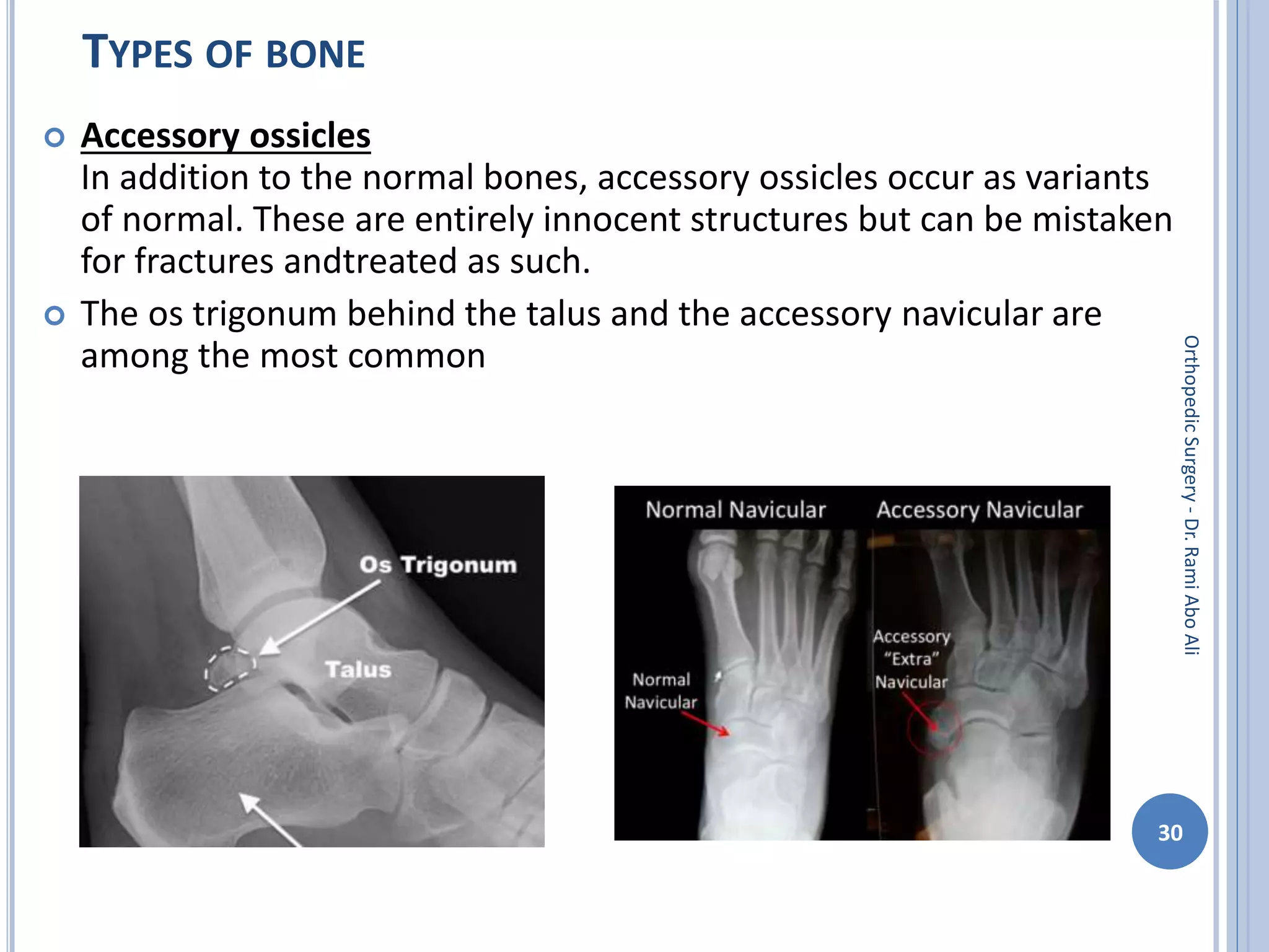 Introduction to Orthopedic surgery | PPTX