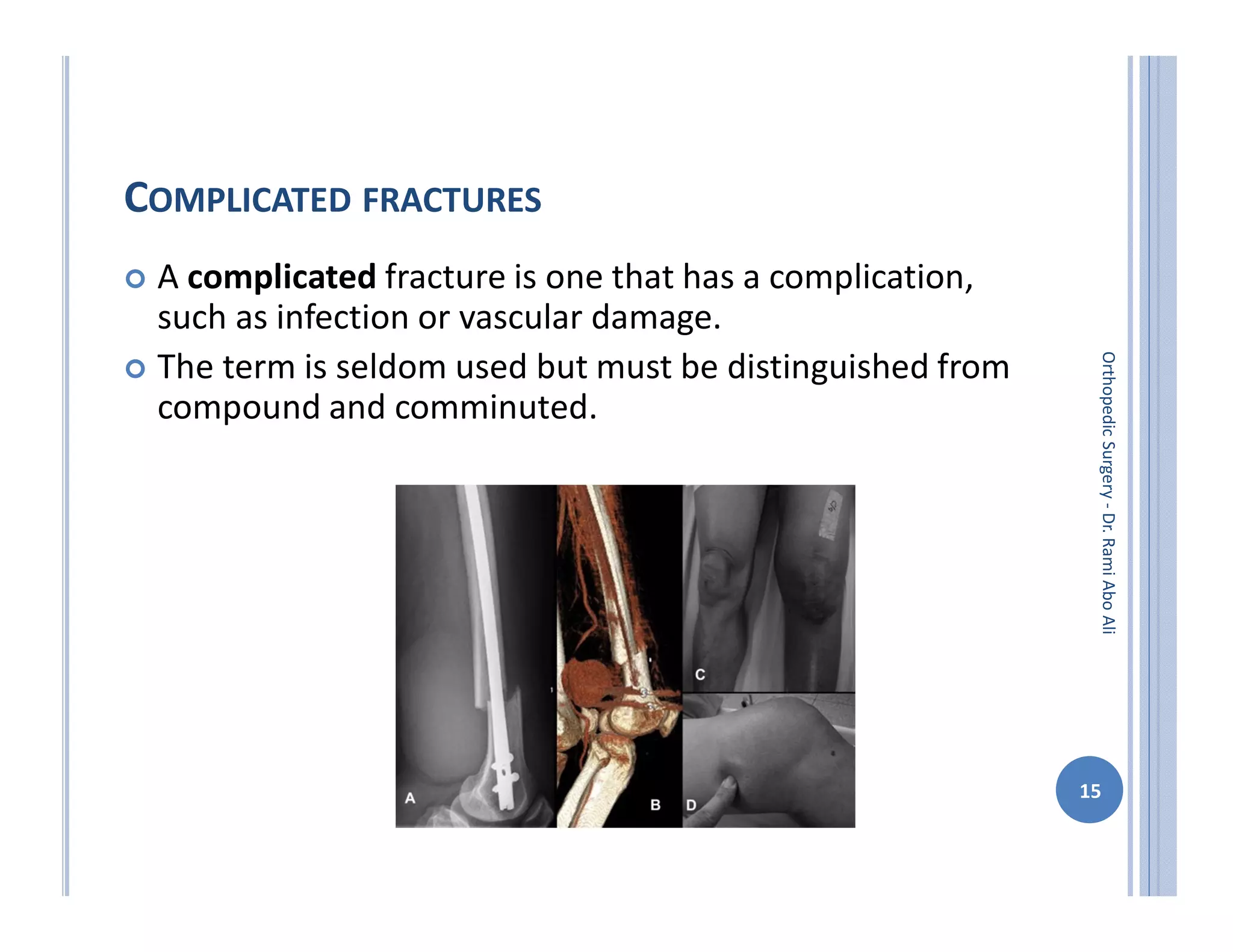 Orthopedic Surgery 2nd General Principles In Fractures Pdf