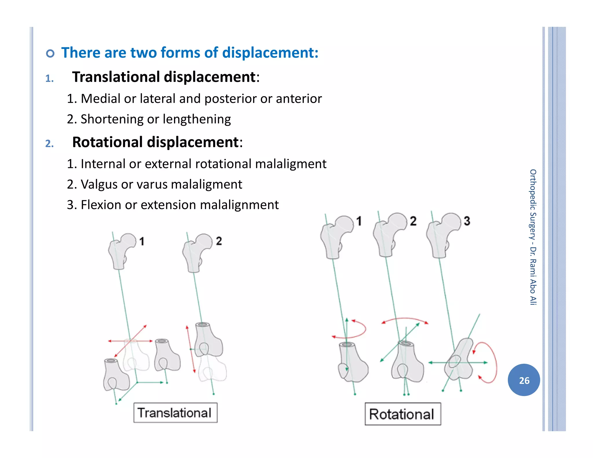 Orthopedic surgery 2nd general principles in fractures | PDF