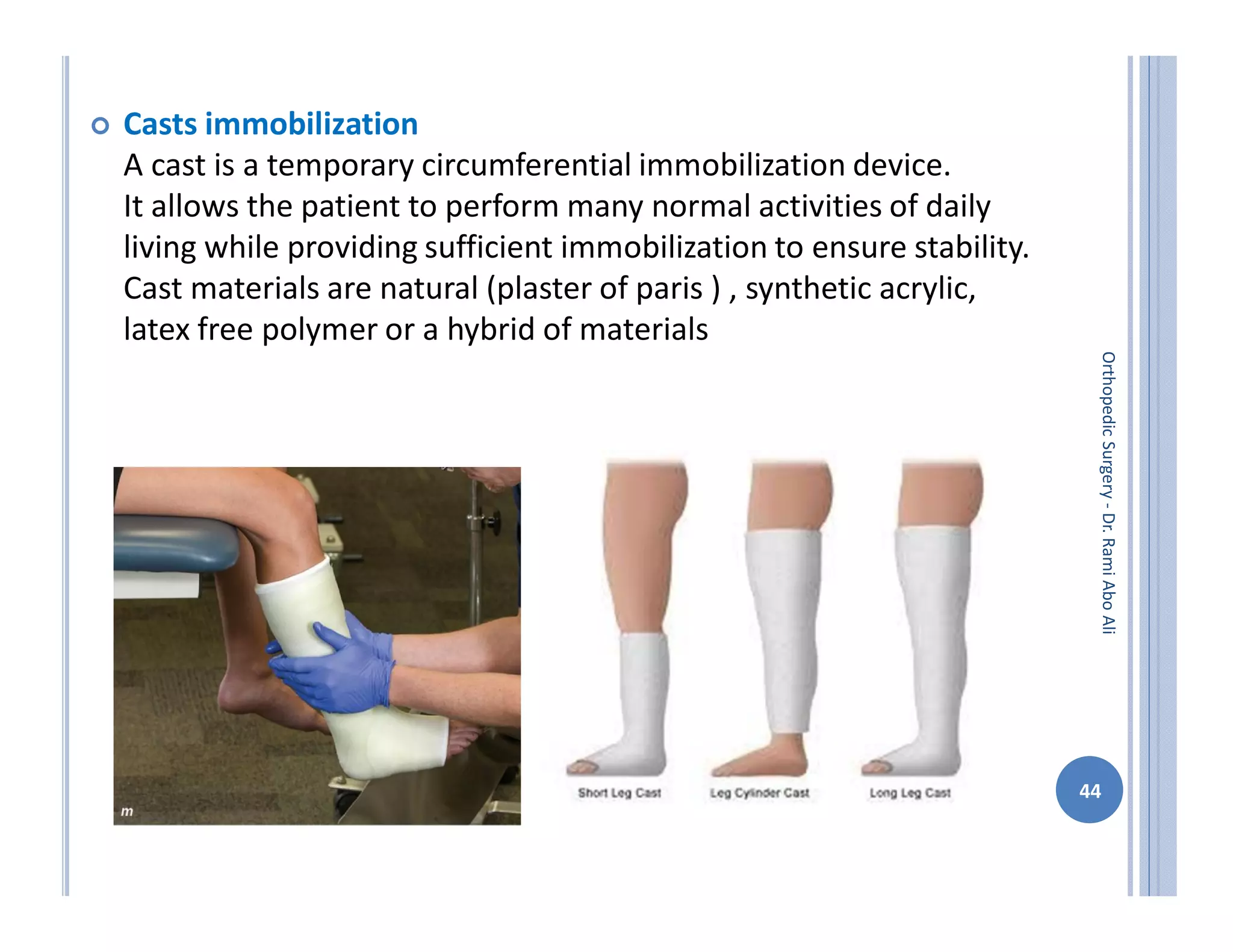 Orthopedic surgery 2nd general principles in fractures | PDF