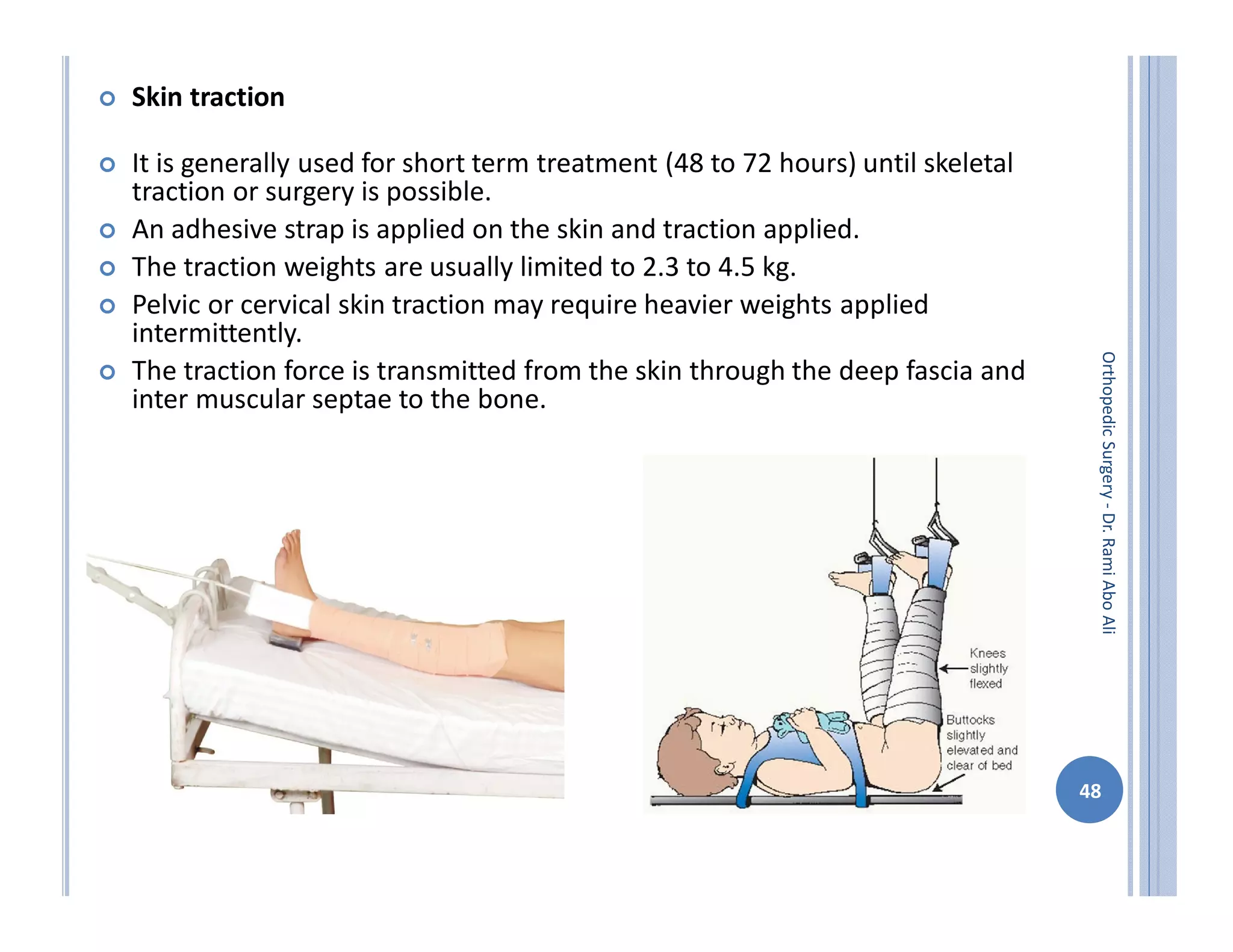 Orthopedic surgery 2nd general principles in fractures | PDF