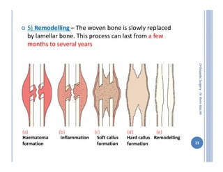 Orthopedic surgery 2nd general principles in fractures | PDF