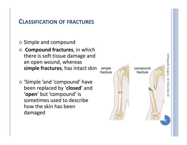 Orthopedic surgery 2nd general principles in fractures | PPT