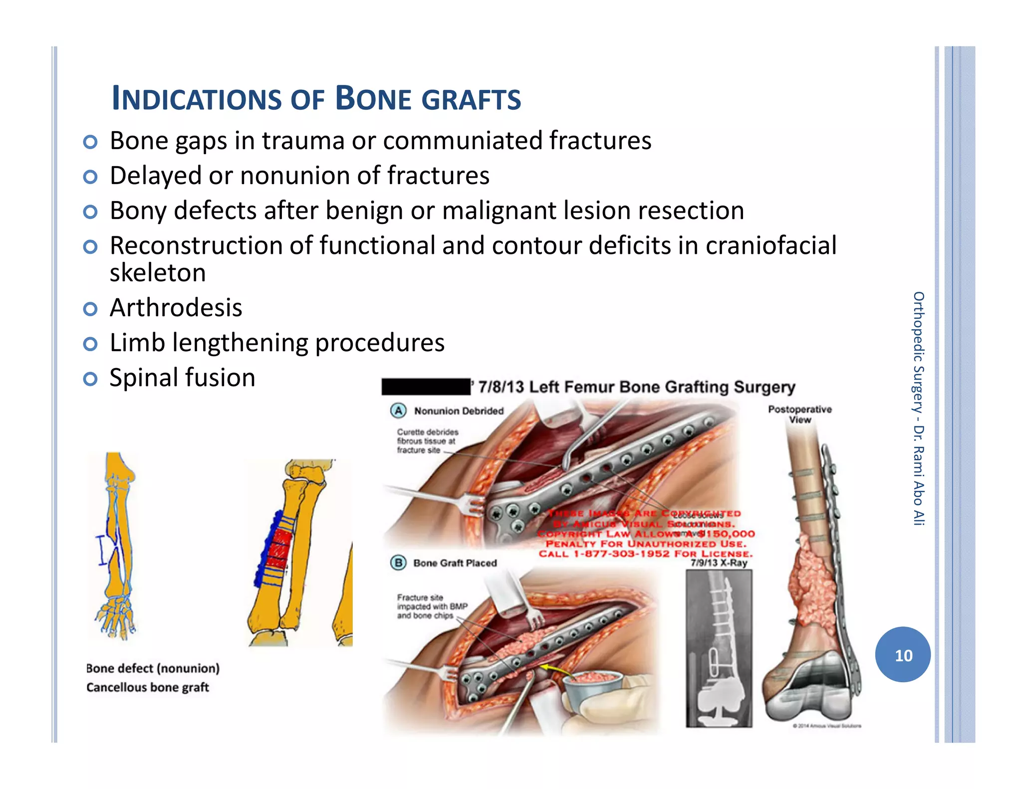 Orthopedic surgery 3rd complications of fractures | PDF