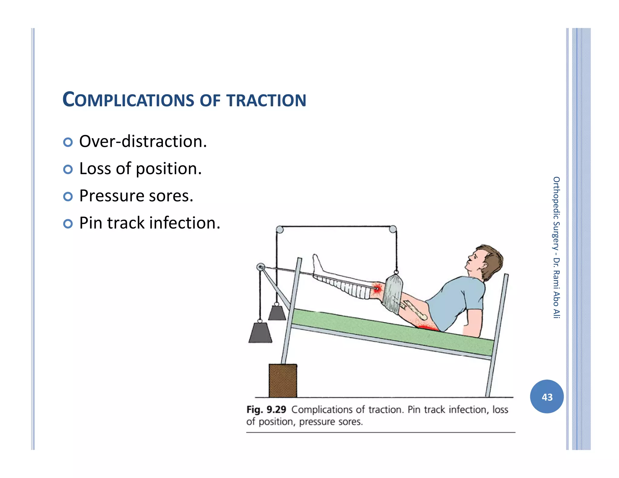 Orthopedic surgery 3rd complications of fractures | PDF