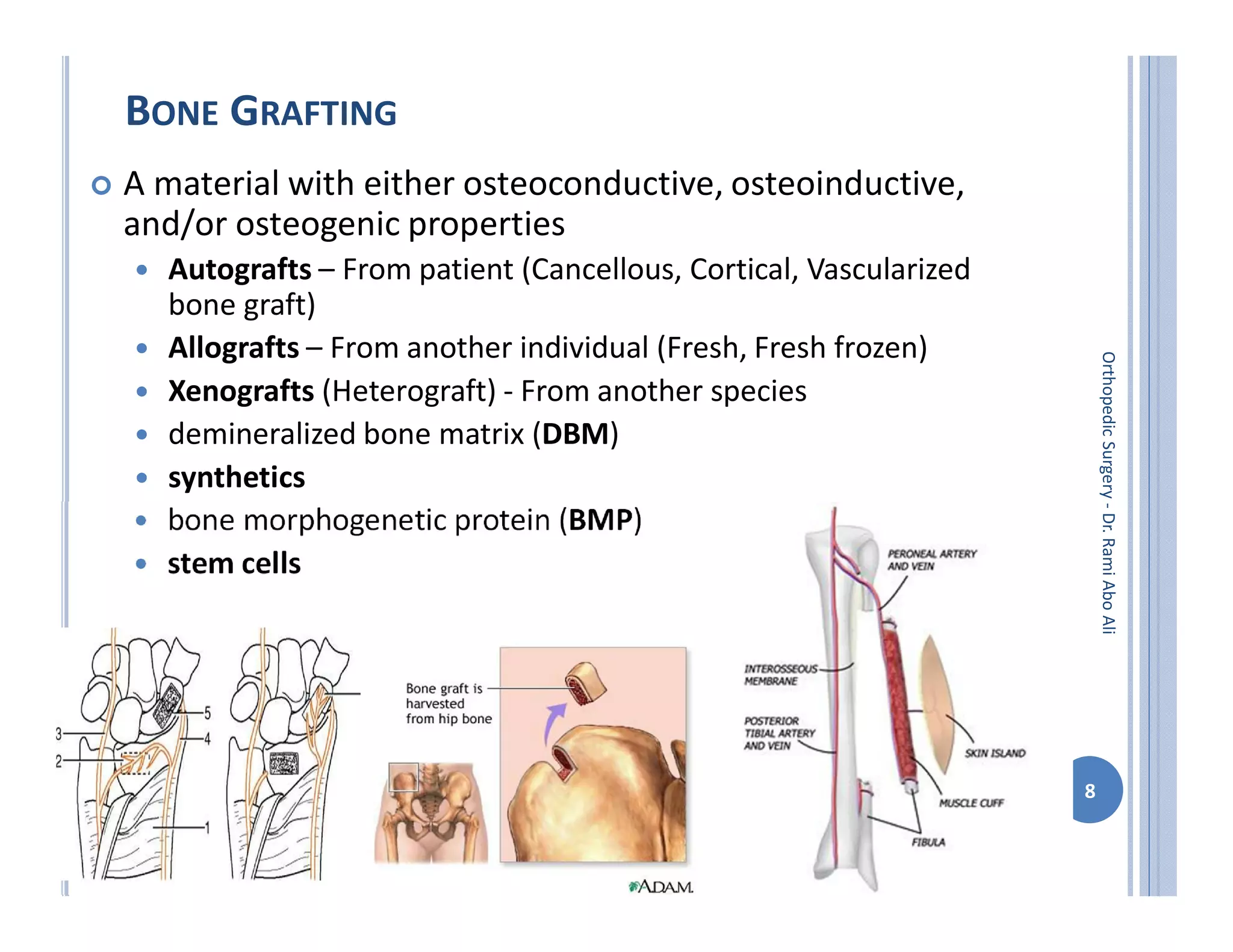 Orthopedic surgery 3rd complications of fractures | PDF
