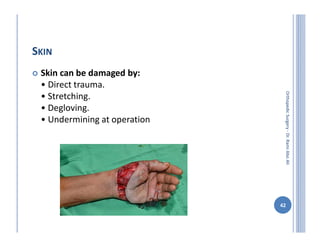 Orthopedic surgery 3rd complications of fractures | PDF