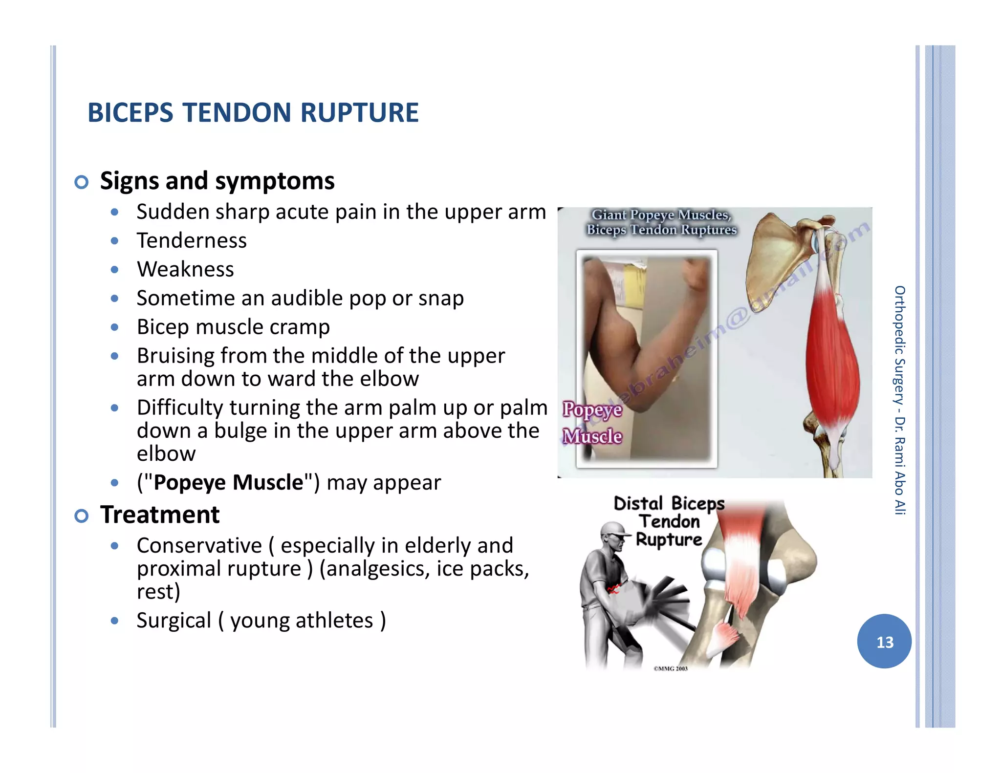 Orthopedic surgery 5th injuries to the upper limb ( 2 ) | PDF
