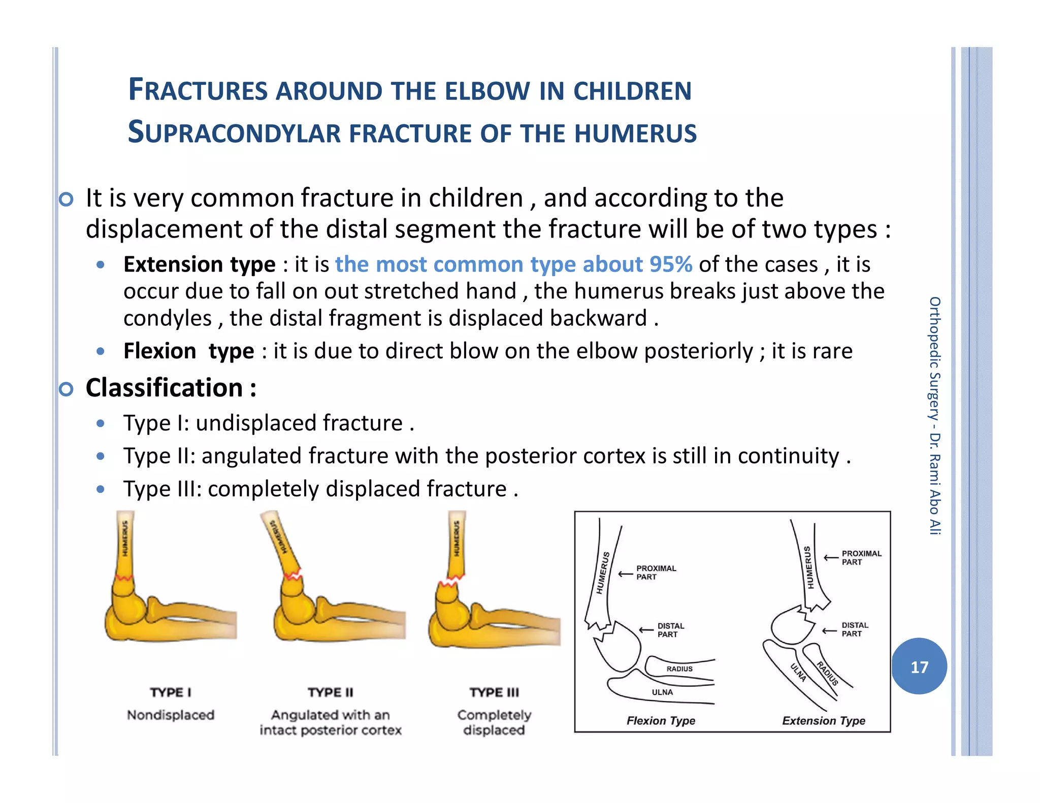 Orthopedic surgery 5th injuries to the upper limb ( 2 ) | PDF