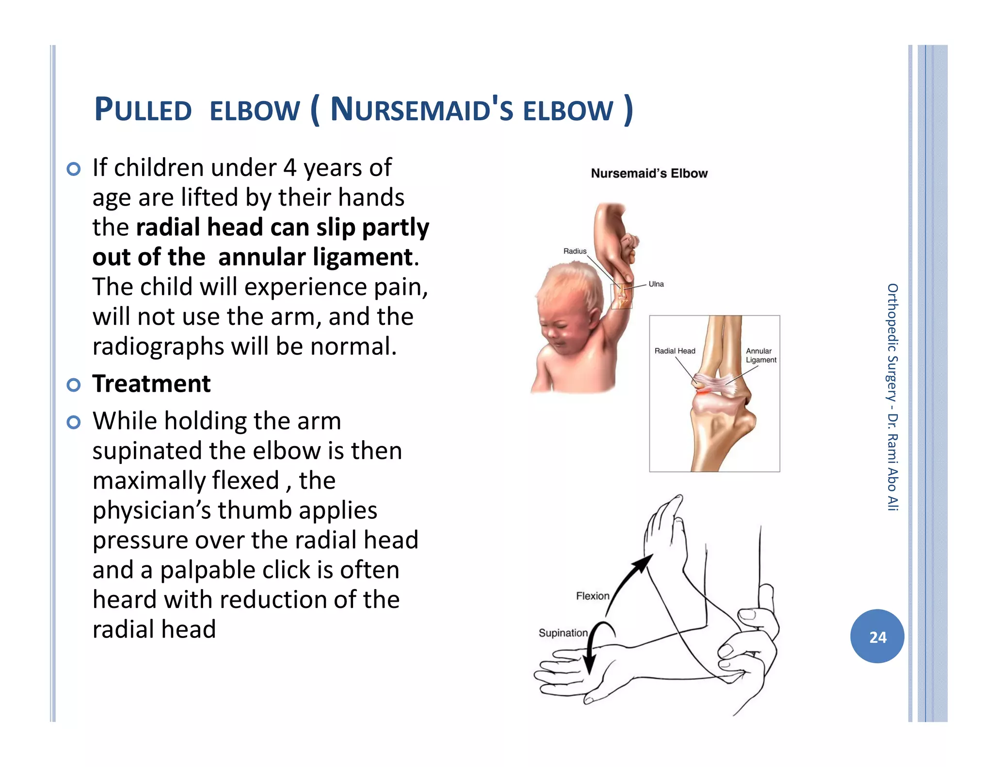 Orthopedic surgery 5th injuries to the upper limb ( 2 ) | PDF