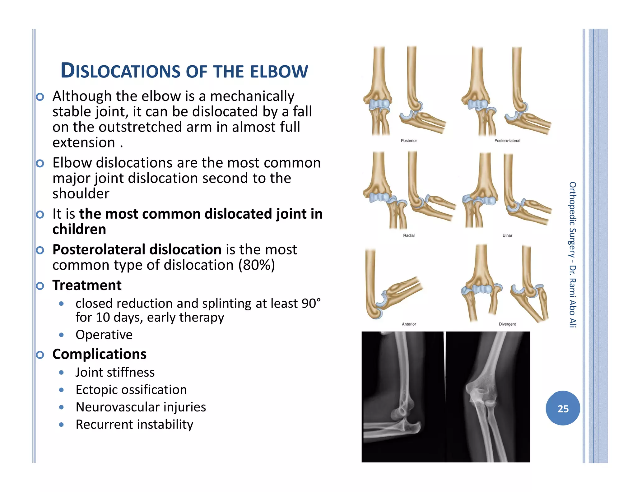 Orthopedic surgery 5th injuries to the upper limb ( 2 ) | PDF