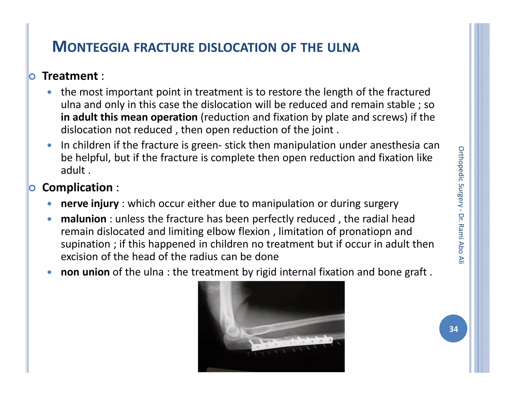 Orthopedic surgery 5th injuries to the upper limb ( 2 ) | PDF