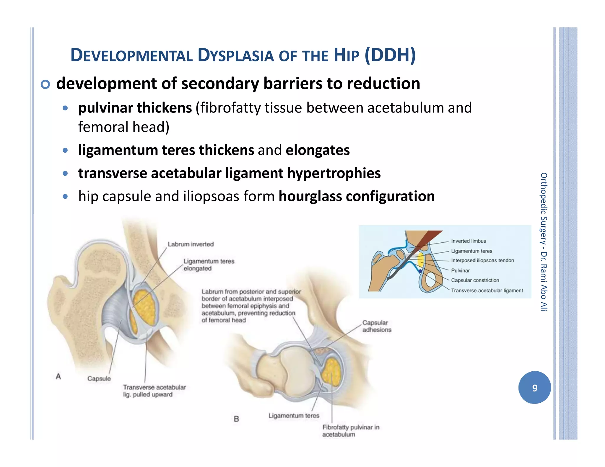 Orthopedic surgery 9th pediatric orthopedic ( 1 ) | PDF | Pregnancy ...