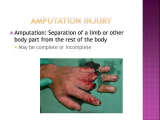 Orthopedic trauma care | PPTX