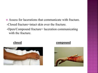 Orthopedic trauma care | PPTX