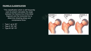 fracture of neck of femur | PPTX