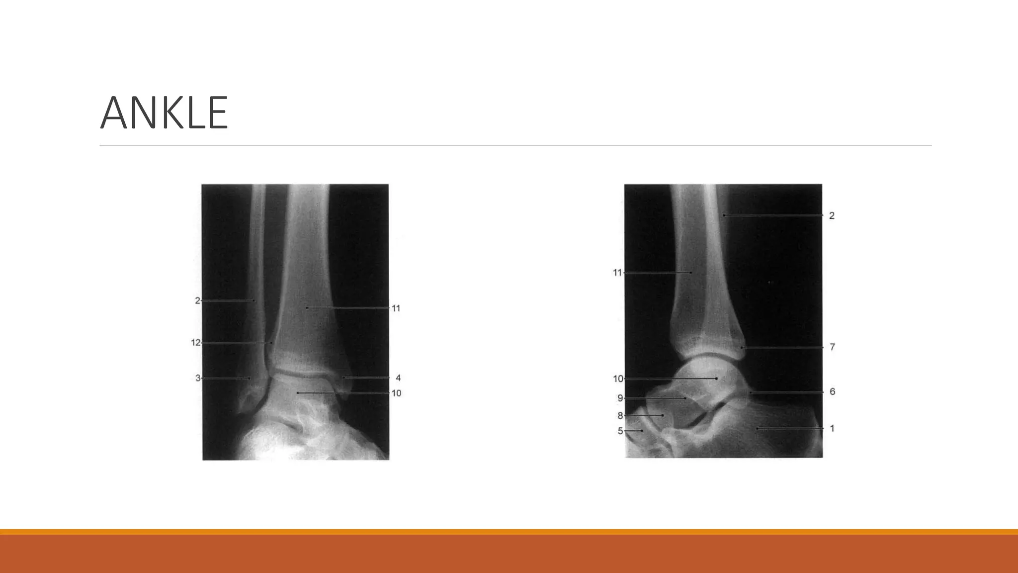 ORTHOPEDIC XRAYS.pptx