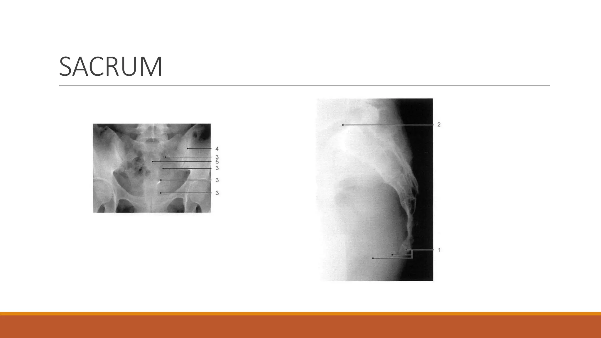 ORTHOPEDIC XRAYS.pptx