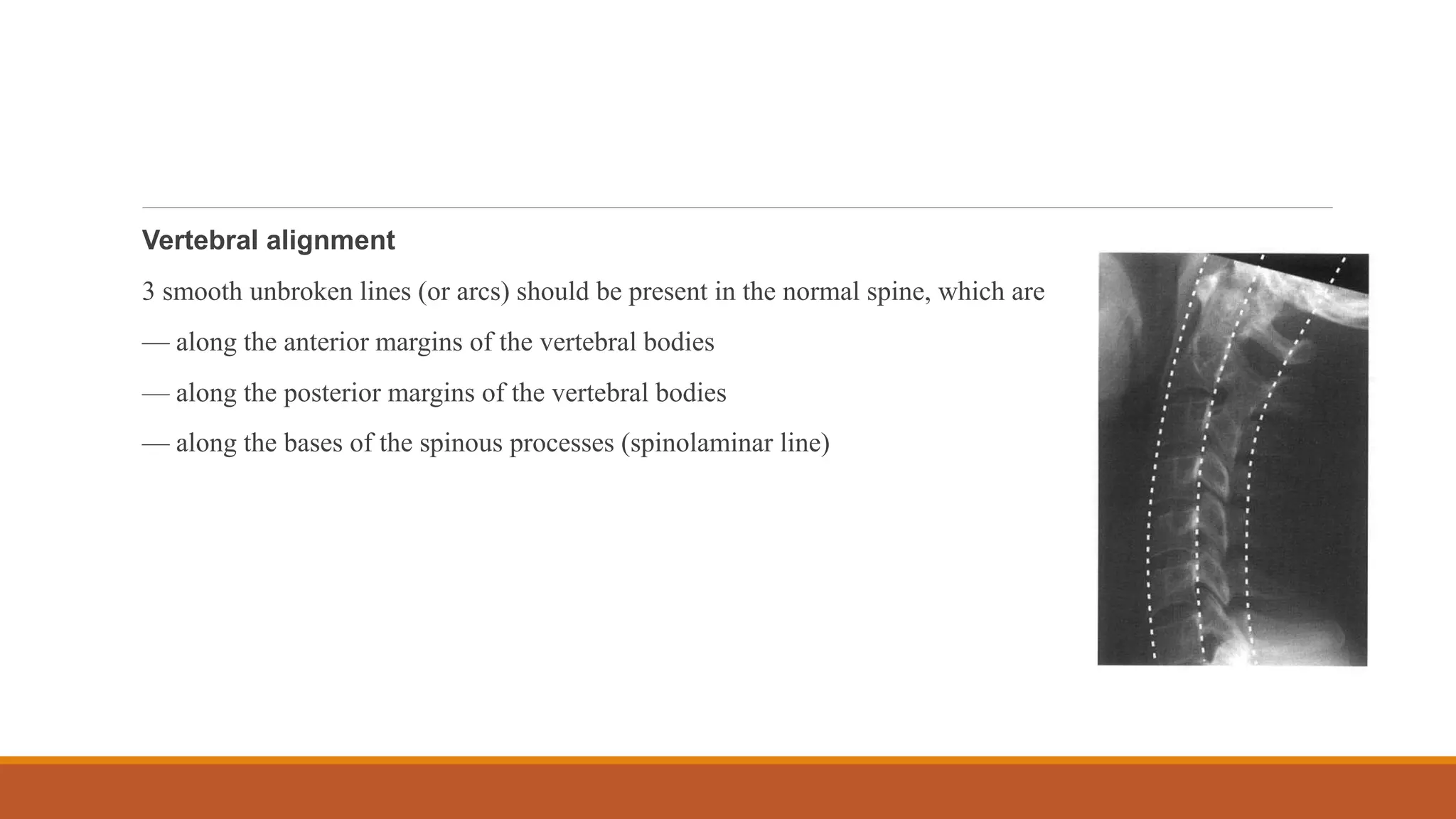 ORTHOPEDIC XRAYS.pptx