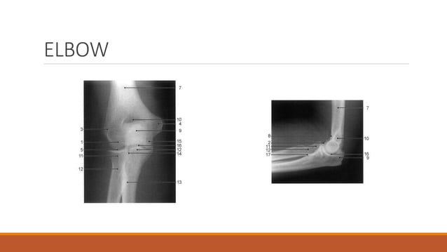 ORTHOPEDIC XRAYS.pptx