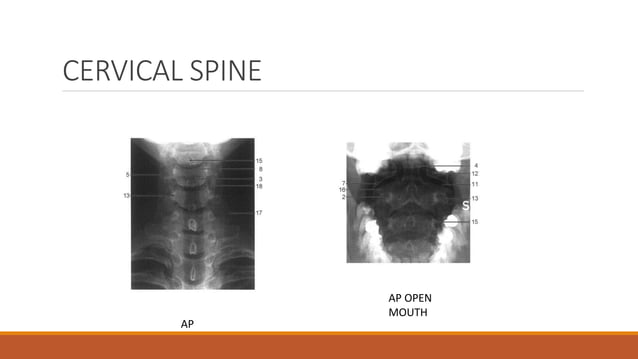 ORTHOPEDIC XRAYS.pptx
