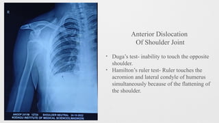 Orthopaedic Important X-rays for final year MBBS. | PPT