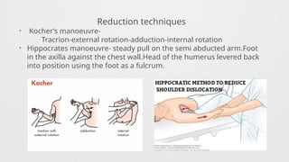 Orthopaedic Important X-rays for final year MBBS. | PPTX