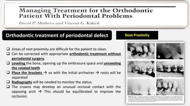 Managing treatment for the orthodontic patient with periodontal ...
