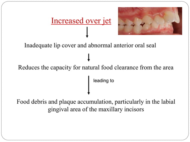 ortho_perio_final.pptx