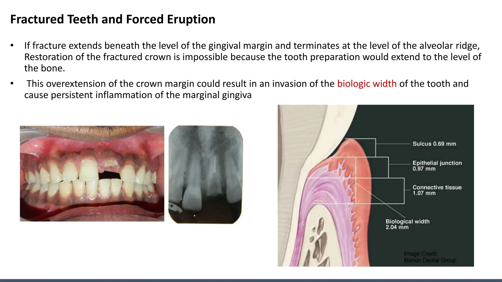 Ortho perio relationیییییییییییییییs.pptx