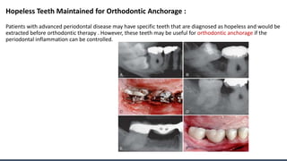 Ortho perio relationیییییییییییییییs.pptx