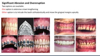 Ortho perio relationیییییییییییییییs.pptx