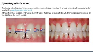 Ortho perio relationیییییییییییییییs.pptx