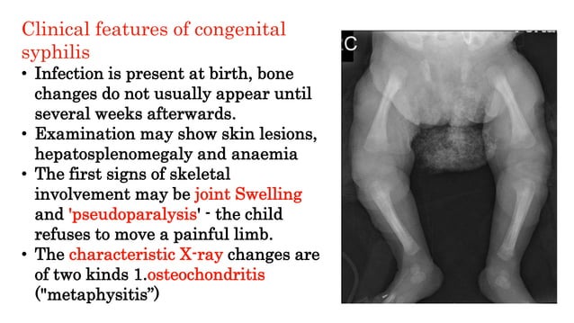 ortho5rudeudrifififjfffjfrjchc yu xtcccicuc | PPT
