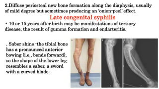 ortho5rudeudrifififjfffjfrjchc yu xtcccicuc | PPT