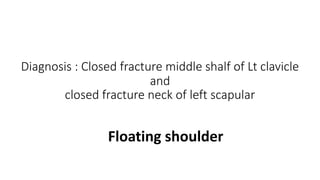 Floating shoulder | PPTX