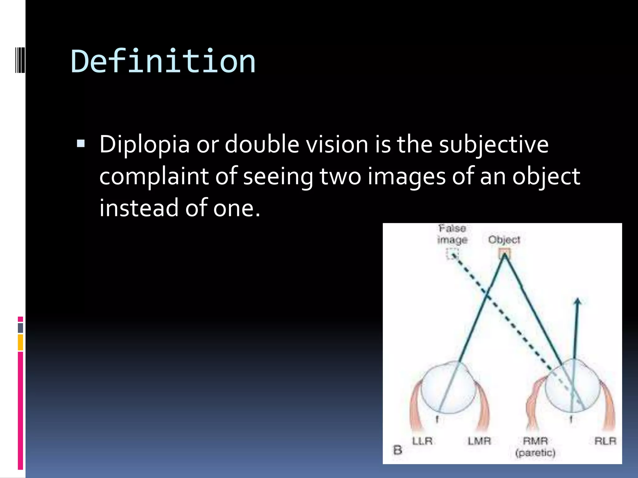 Orthoptic approach to dipolopia | PPT