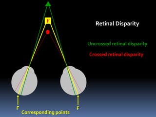 Orthoptic approach to dipolopia | PPTX