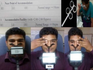 Orthoptic evaluation 1 | PPTX