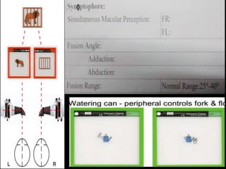 Orthoptic evaluation 1 | PPTX