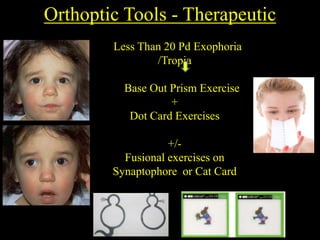 Orthoptic evaluation 1 | PPTX