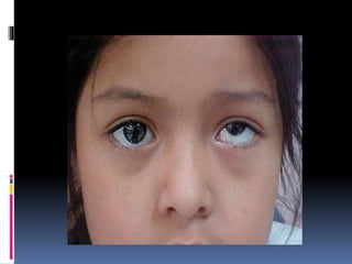Orthoptic examination | PPTX