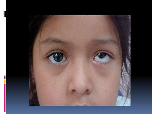 Orthoptic examination | PPT