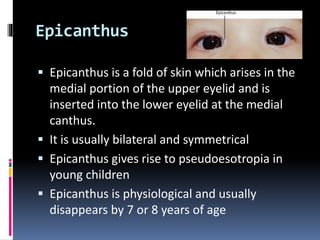 Orthoptic examination | PPTX